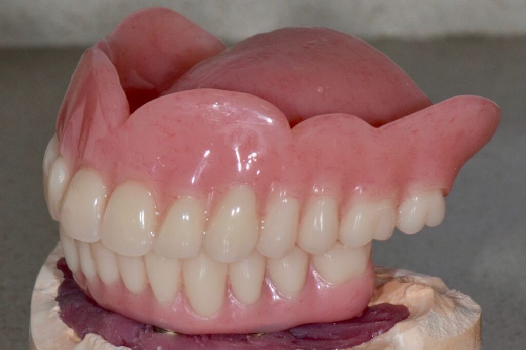 When Is It Too Late to Save a Tooth? - Kelmscott Dental