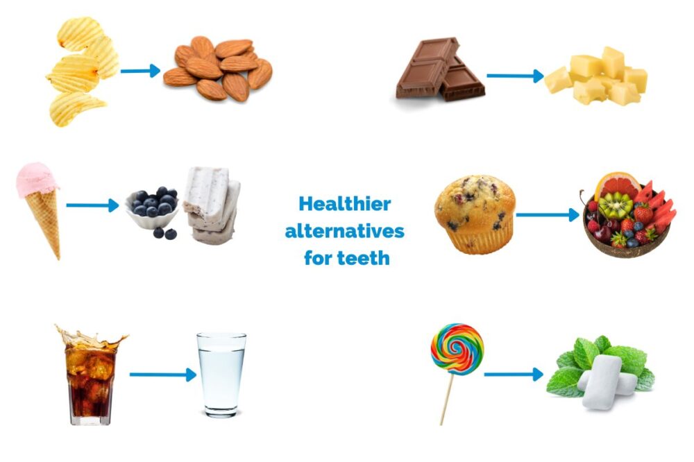 7 Foods That Can Harm Teeth - Kelmscott Dental